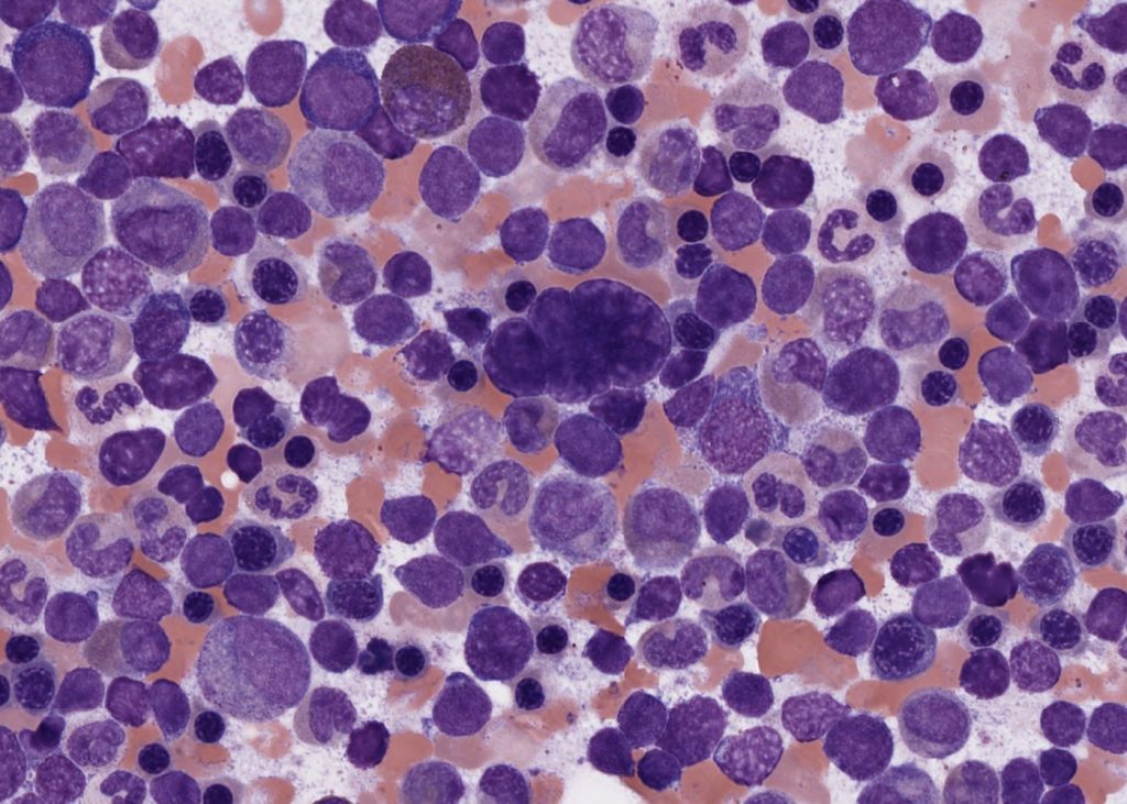 Bone Marrow Meyers Histology Bone Marrow Meyers Histology