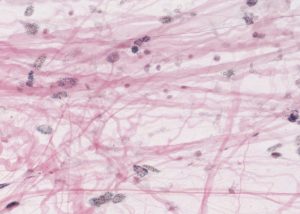 Connective Tissue Meyers Histology